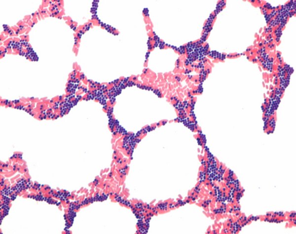 Gram-Color Stain set for the Gram staining method - Labchem Catalog